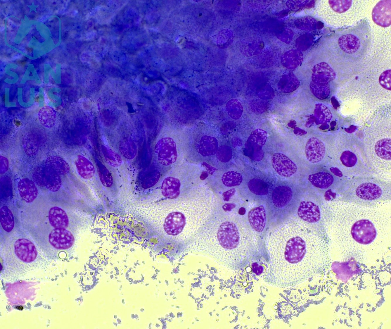 Citología – Laboratorio San Luis